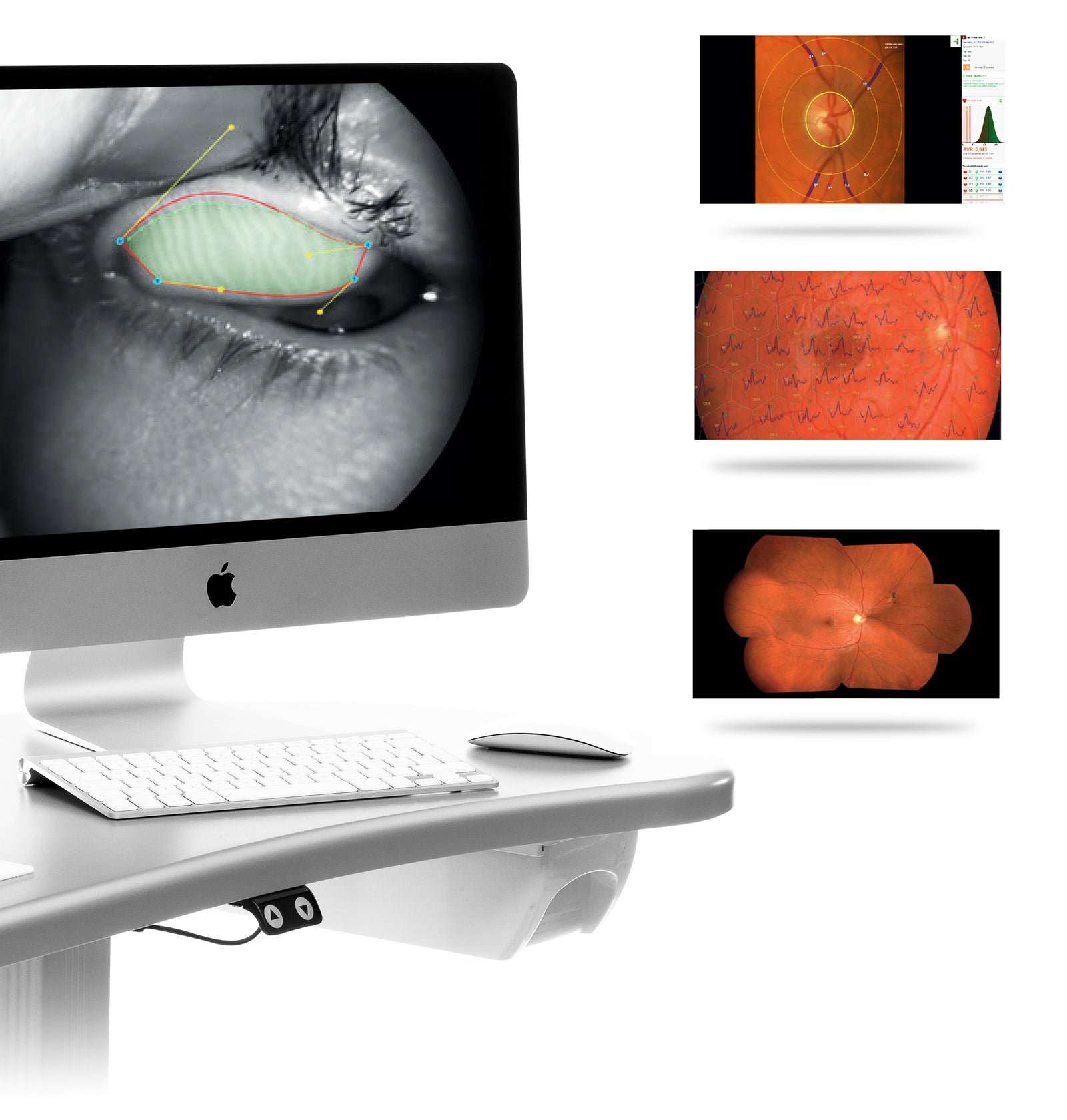 CSO Retinal Camera Cobra HD – Chicago Ophthalmic Services, Inc.