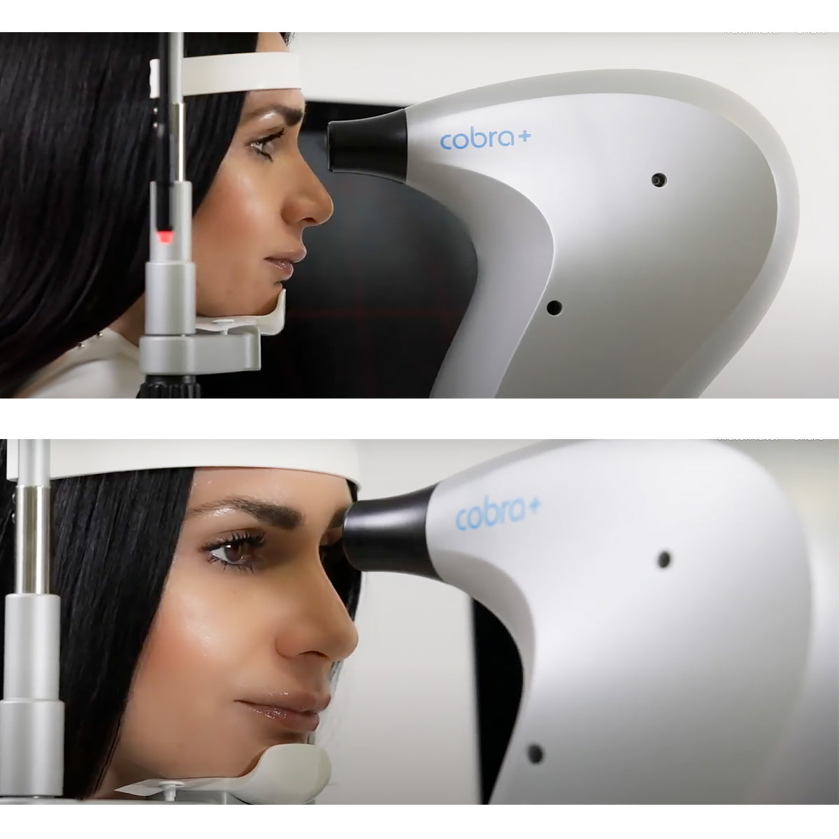 CSO Retinal Camera Cobra Plus – Chicago Ophthalmic Services, Inc.
